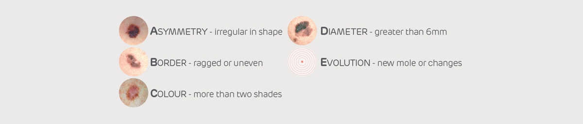 molemap-website | MoleMap Australia