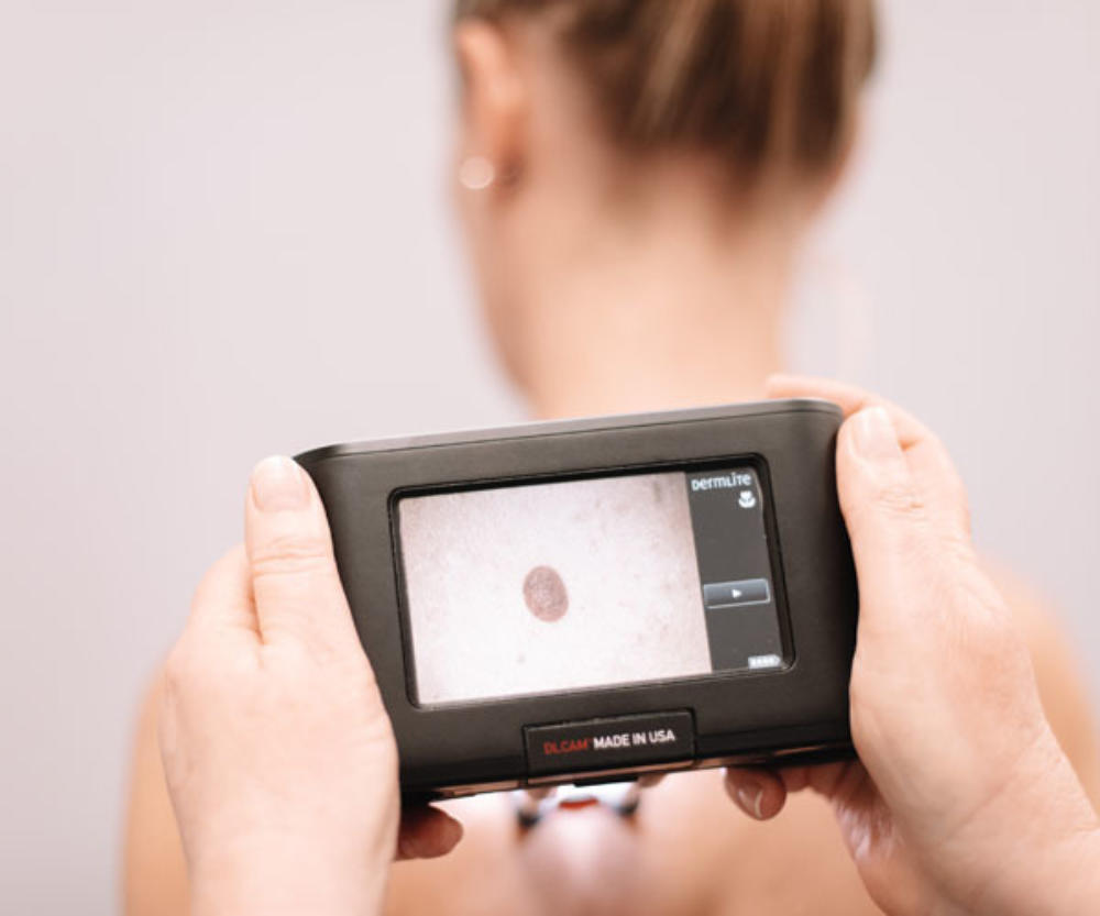 Home | MoleMap NZ Official Site