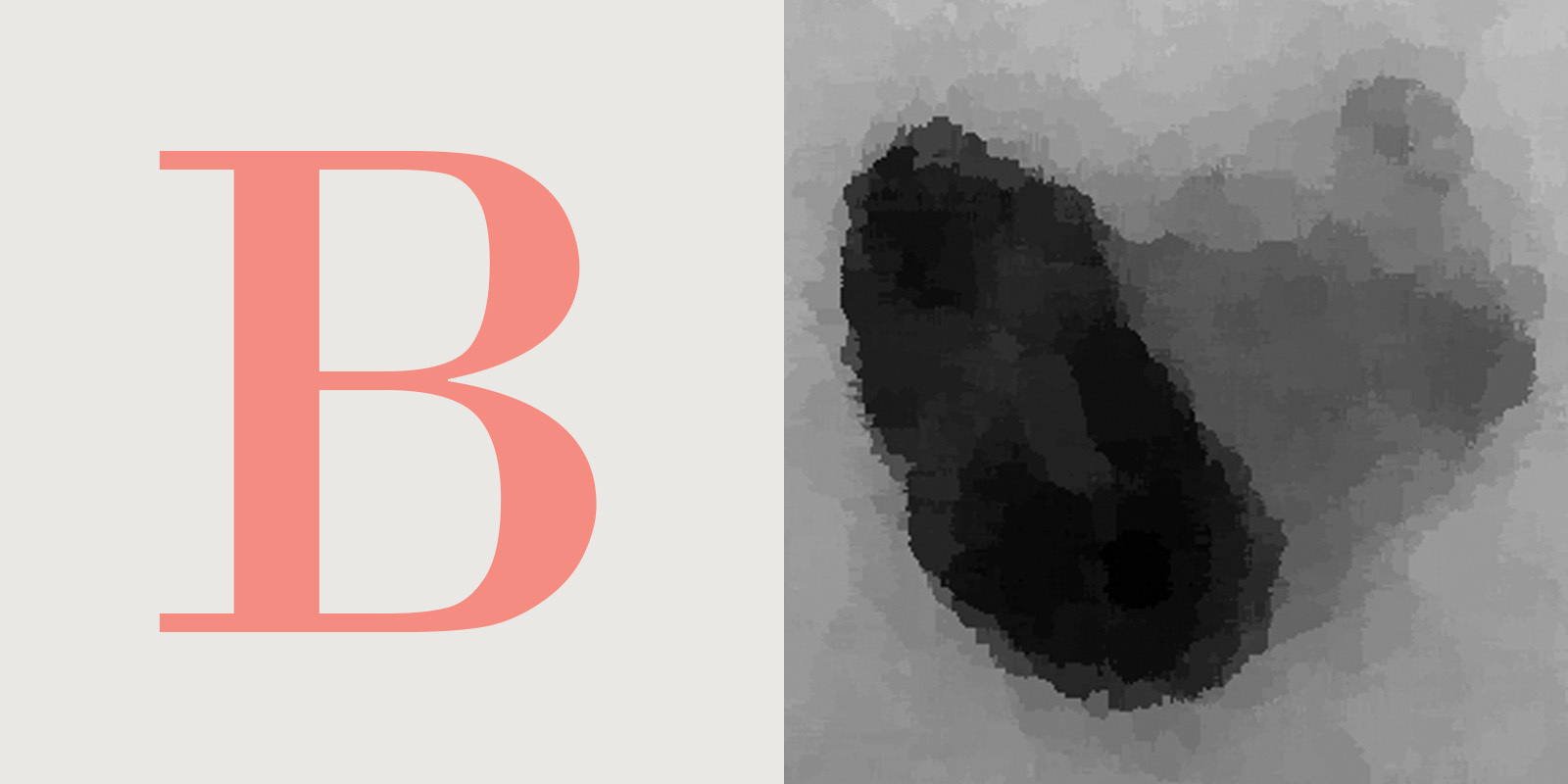 How Do I Know If It's Melanoma? - Molemap Australia